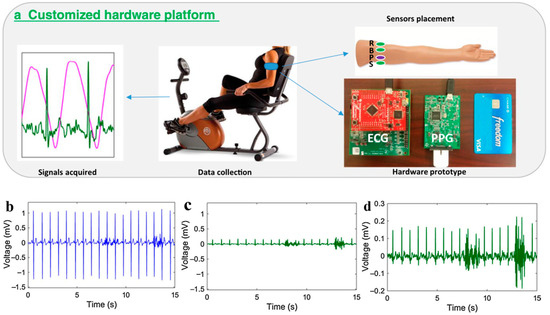 Wearable Continuous Blood Pressure Monitoring Devices Based on Pulse ...