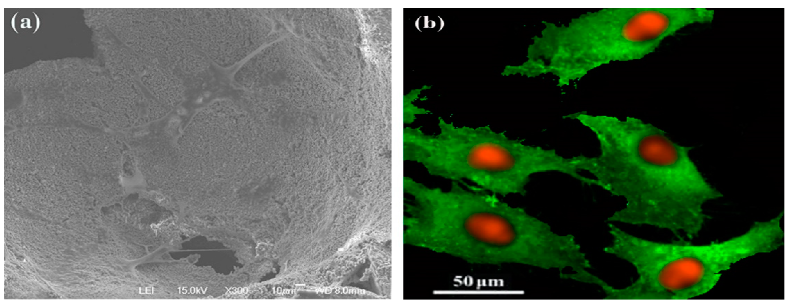 Mangiferin-Enriched Mn–Hydroxyapatite Coupled with β-TCP Scaffolds ...