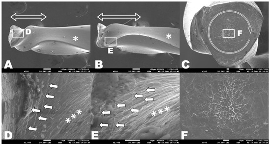 Effect from Autoclave Sterilization and Usage on the Fracture ...