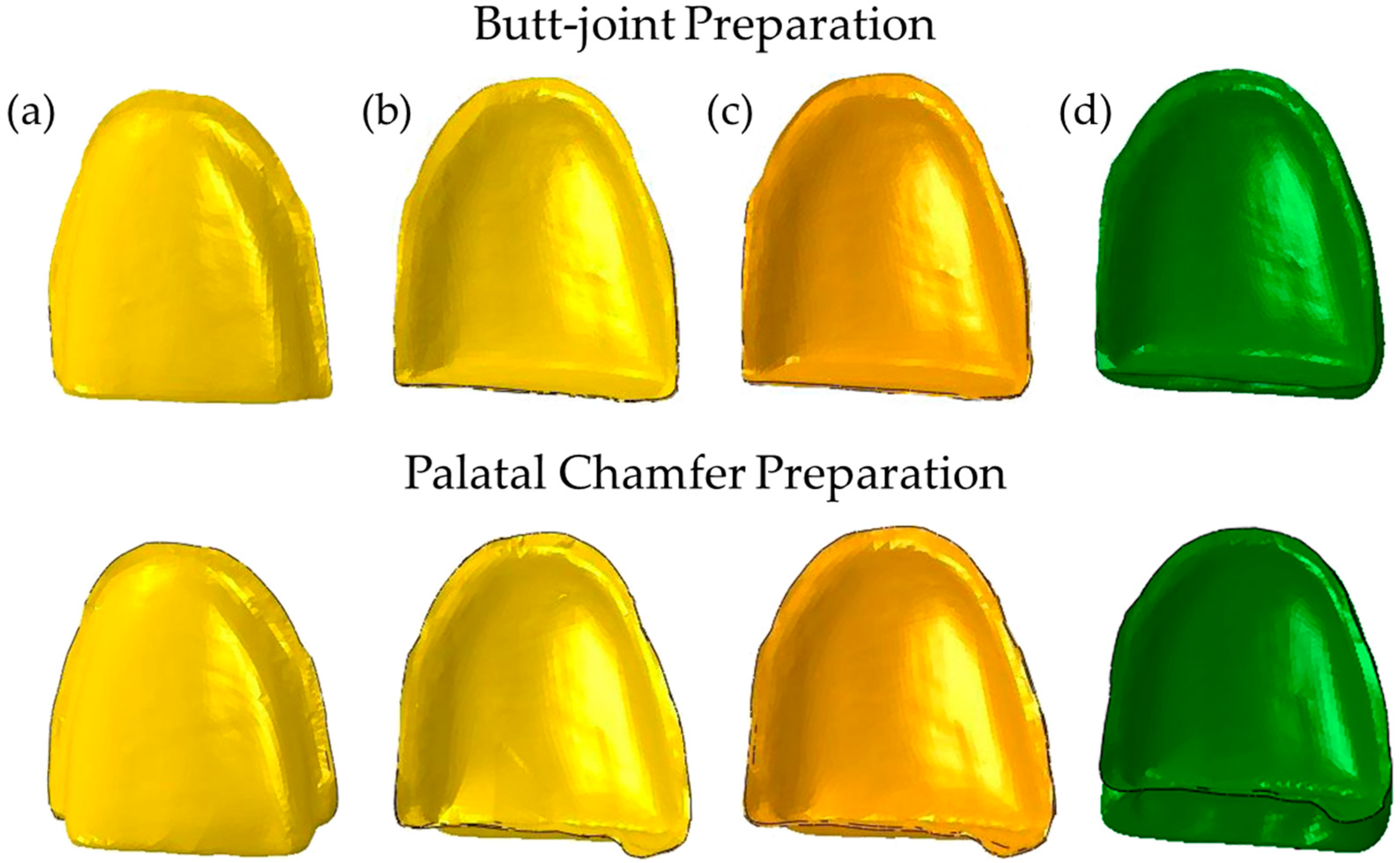 Biomechanical Behavior Evaluation of Resin Cement with Different ...