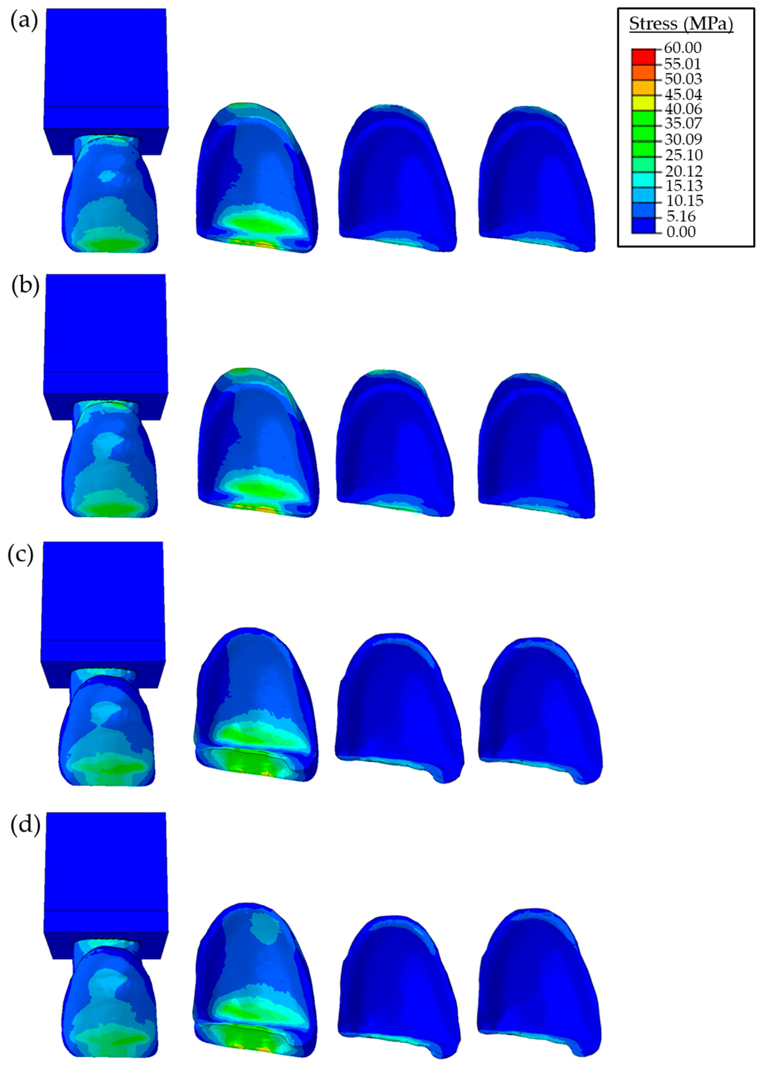 Biomechanical Behavior Evaluation of Resin Cement with Different Elastic Modulus on Porcelain ...
