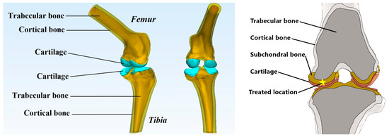 Finite Element Analysis of Different Osseocartilaginous Reconstruction ...