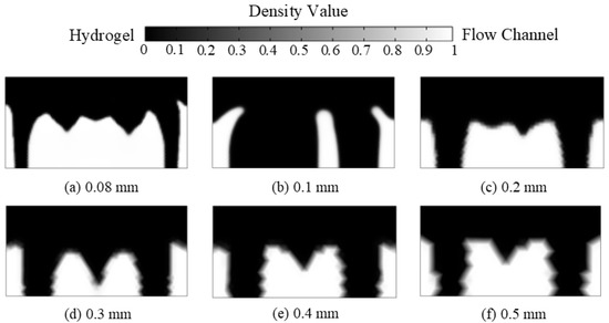 Topological Optimisation Structure Design for Personalisation of ...