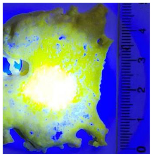 The Optimization of Radiation Synthesis Modes for YAG:Ce Ceramics