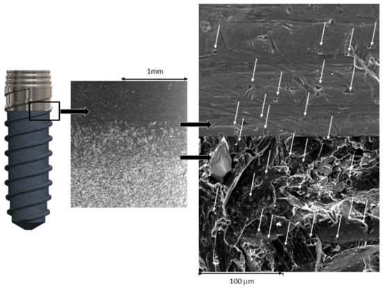 Materials | Free Full-Text | Corrosion Resistance and Titanium Ion ...