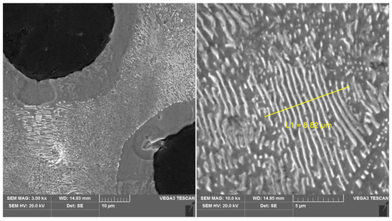 Influence of Heat Treatment Parameters of Austempered Ductile Iron on the Microstructure ...