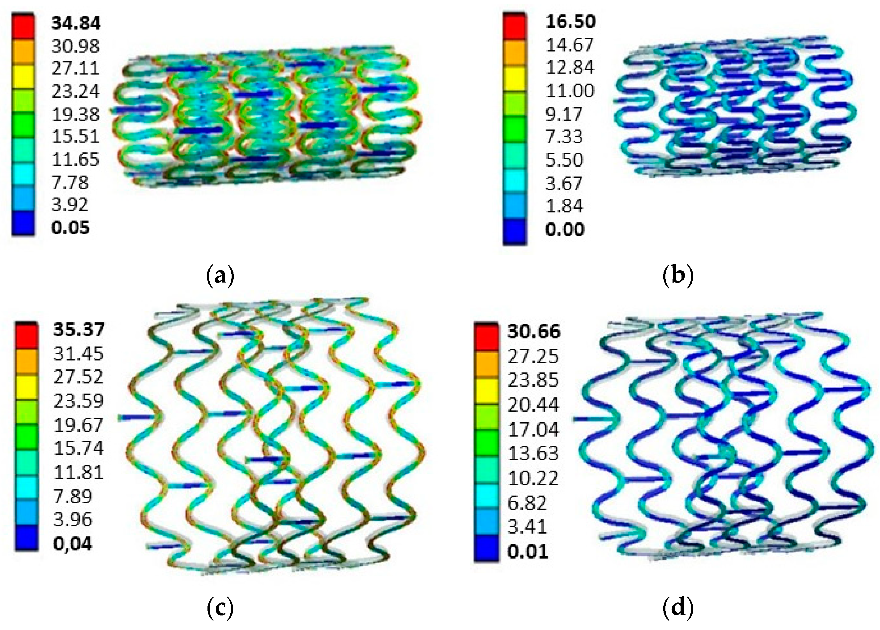 Bioabsorbable Polymeric Stent for the Treatment of Coarctation of the ...