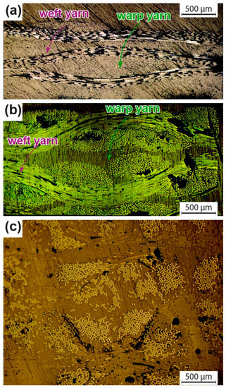 Strength Assessment of PET Composite Prosthetic Sockets
