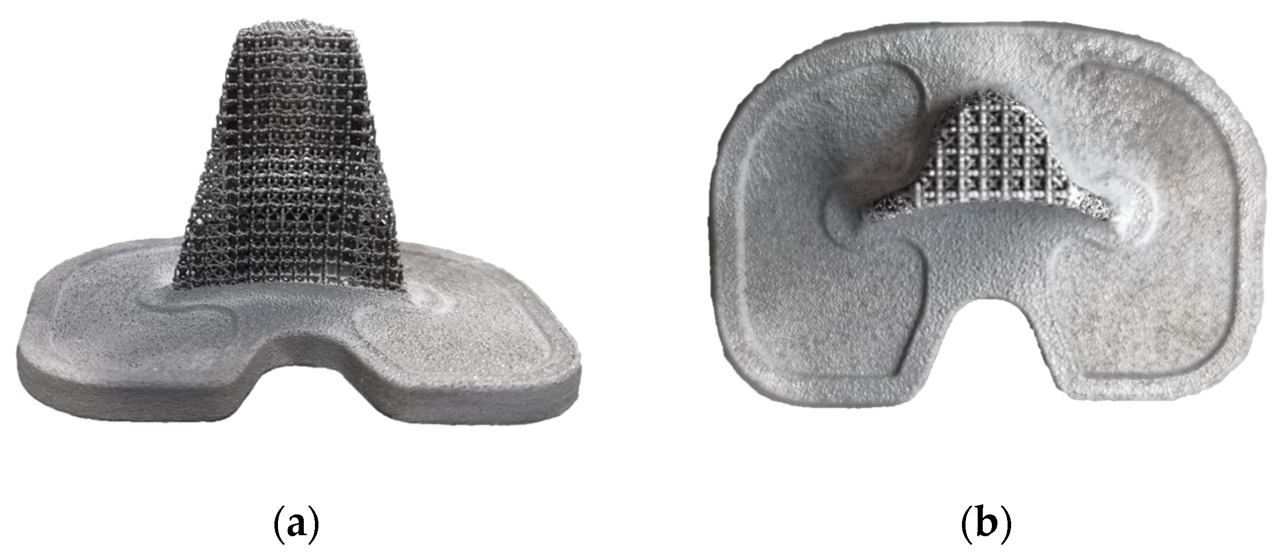 Design and Manufacturing of a Novel Trabecular Tibial Implant