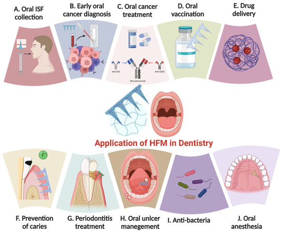 Hydrogel-Forming Microneedles with Applications in Oral Diseases Management