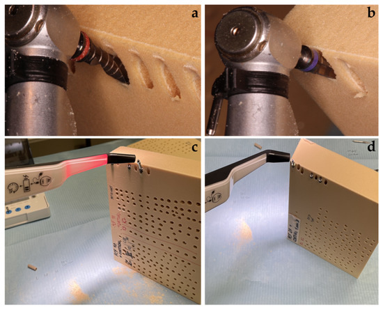 A Comparison of Conical and Cylindrical Implants Inserted in an In ...