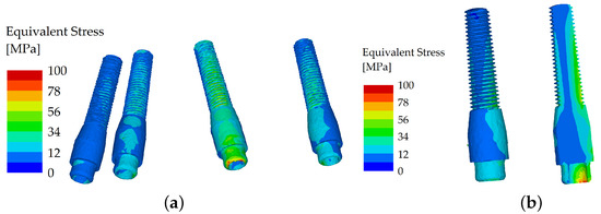 Biomechanical Analysis of Palateless Splinted and Unsplinted Maxillary ...