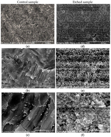 The Shear Bond Strength of Resin-Based Luting Cement to Zirconia ...