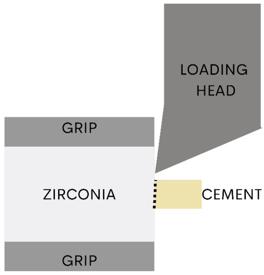 The Shear Bond Strength of Resin-Based Luting Cement to Zirconia ...