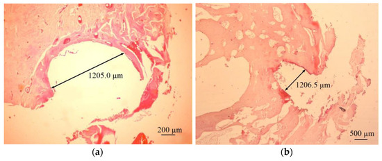 Materials | Free Full-Text | NiTi Shape Memory Clamps with Modified ...