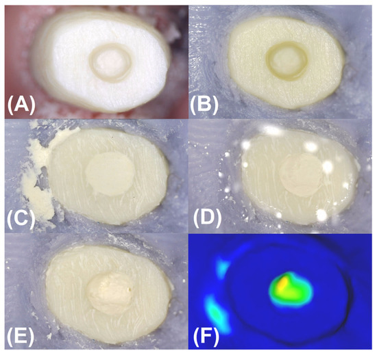 The Washout Resistance of Bioactive Root-End Filling Materials