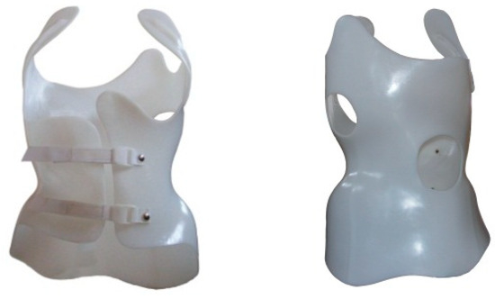 Influence of Undergarments on the Comfort Level of Scoliosis Brace Wearers