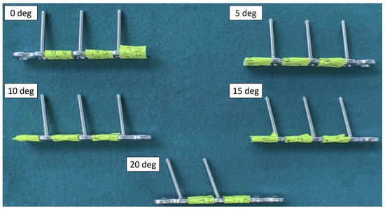 Quantification of Thread Engagement in Screw-Plate Interface of ...
