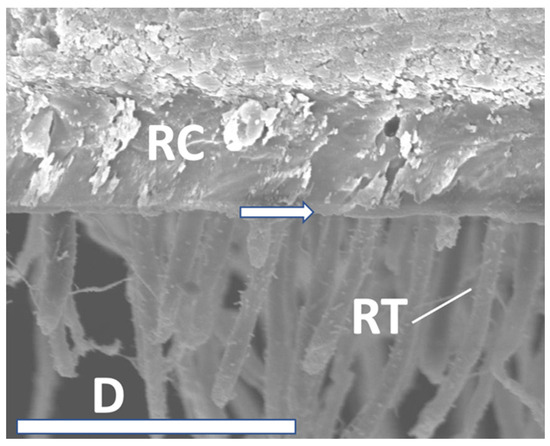 Dentin Bonding Performance of Universal Adhesives in Primary Teeth In Vitro