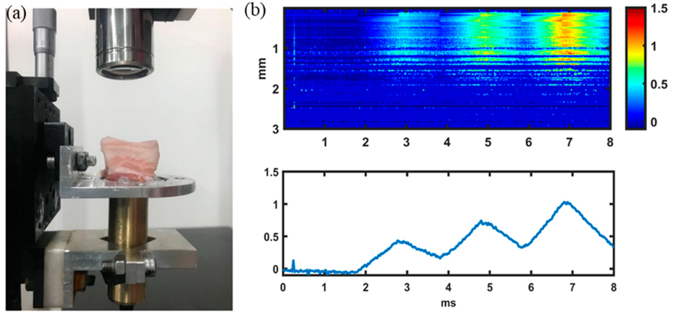 Real-Time Nondestructive Viscosity Measurement of Soft Tissue Based on ...