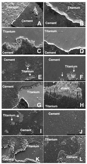 Effects of Surface Treatments and Cement Type on Shear Bond Strength ...