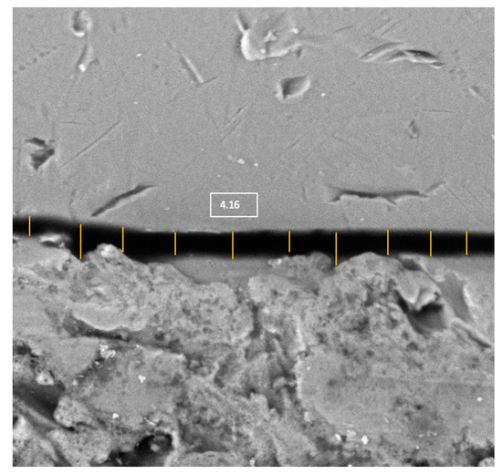 Influence of the Use of Transepithelial Abutments vs. Titanium Base ...