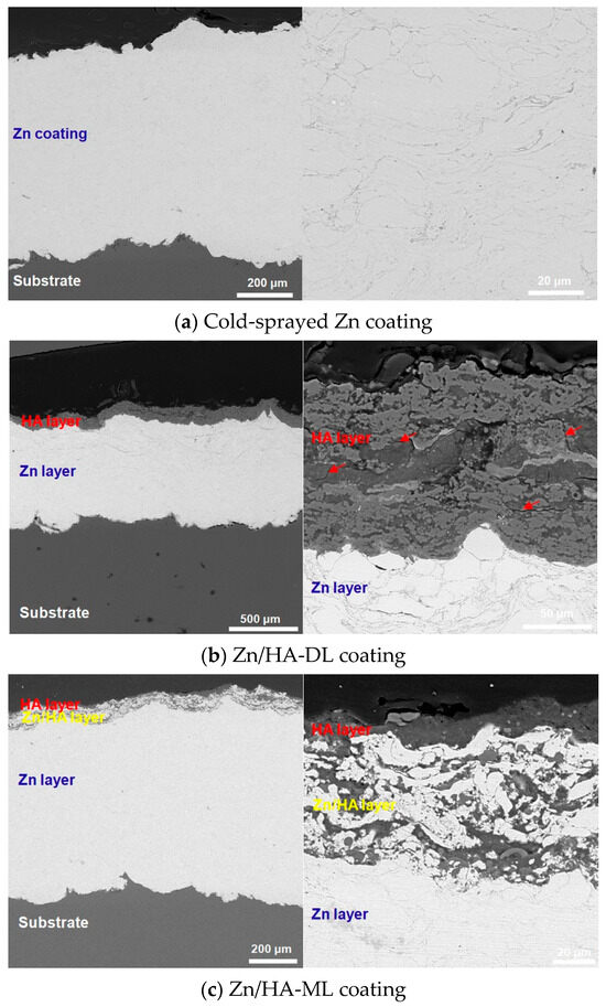 Microstructure and Corrosion Behavior of Zinc/Hydroxyapatite Multi ...
