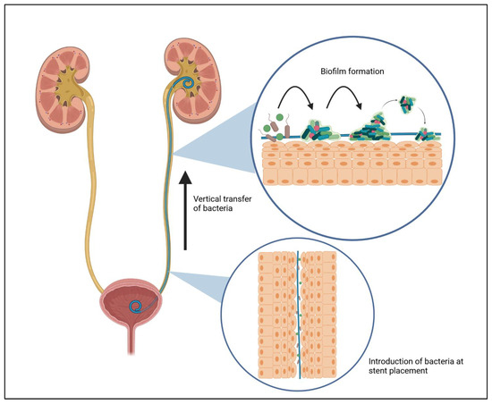 Materials | Free Full-Text | Antimicrobial and Antiproliferative ...