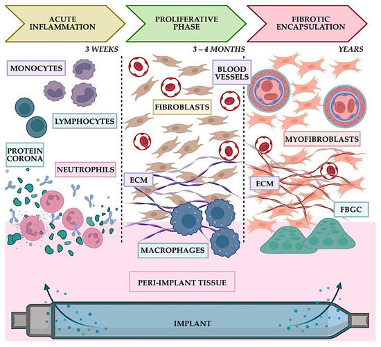 Biocompatibility Testing for Implants: A Novel Tool for Selection and ...