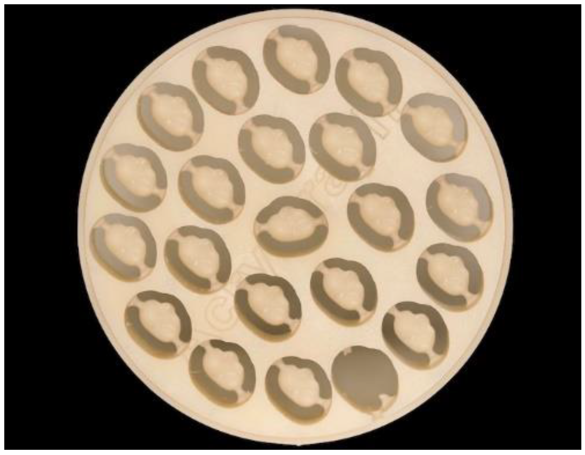 In Vitro Comparison of Internal and Marginal Adaptation between Printed ...