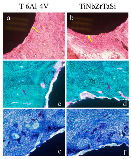 Study on Osseointegration Capability of β-Type Ti–Nb–Zr–Ta–Si Alloy for Orthopedic Implants
