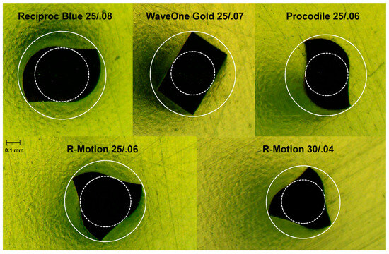 Materials | Free Full-Text | Cyclic Fatigue of Different Reciprocating ...