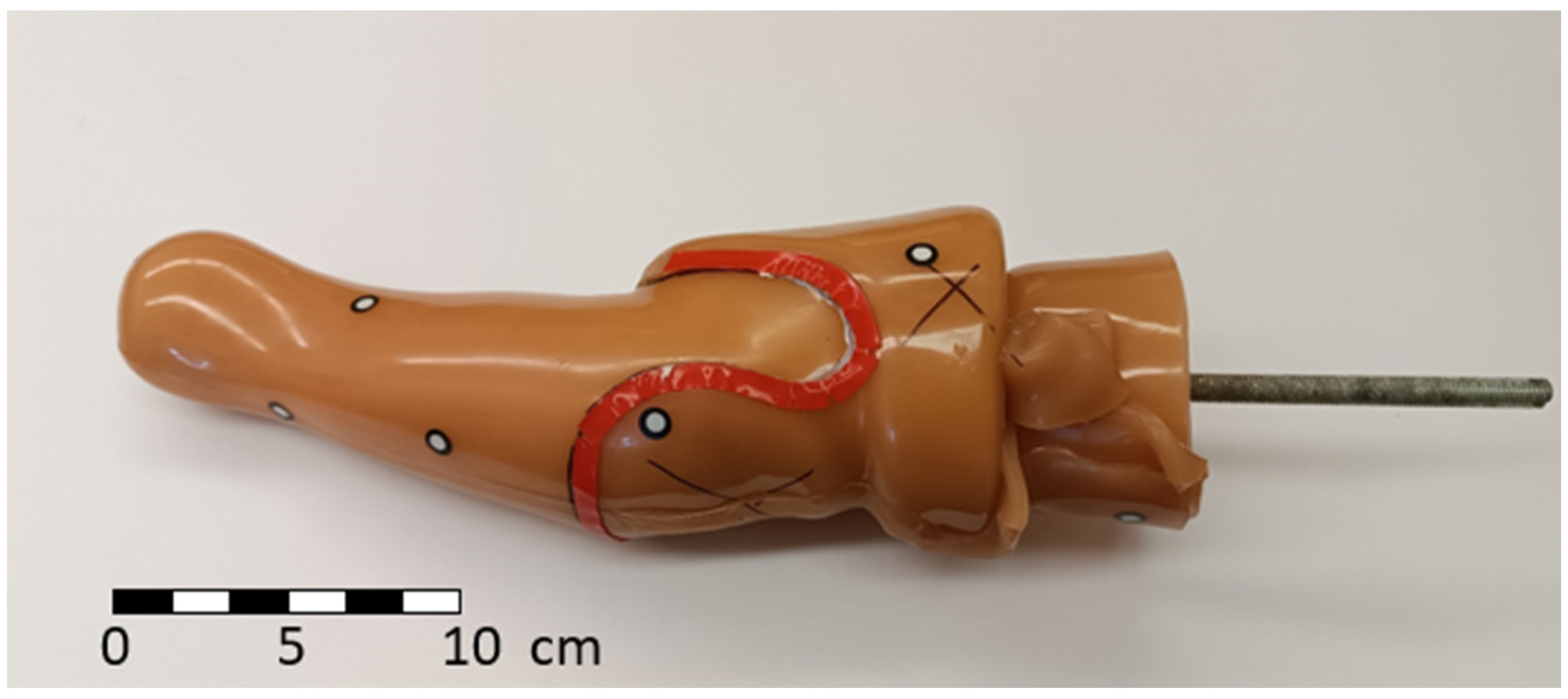 Parametric Production of Prostheses Using the Additive Polymer ...