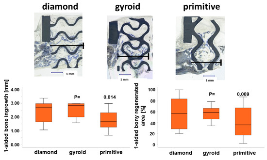 TPMS Microarchitectures for Vertical Bone Augmentation and ...