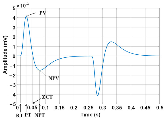 Inspection of Liner Wall Thinning and Interface Debonding in Bimetallic ...