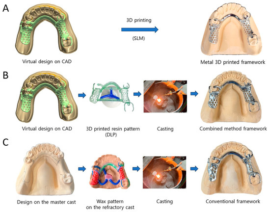 Accuracy of Mandibular Removable Partial Denture Frameworks Fabricated by 3D Printing and ...