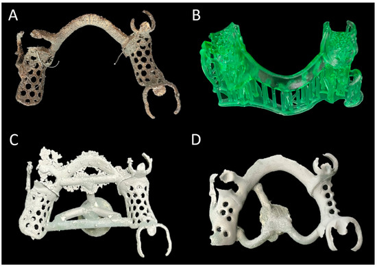 Accuracy of Mandibular Removable Partial Denture Frameworks Fabricated ...