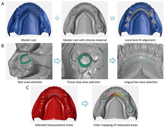 Accuracy of Mandibular Removable Partial Denture Frameworks Fabricated ...
