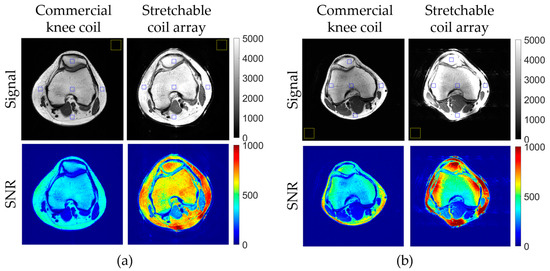 Design and Dynamic In Vivo Validation of a Multi-Channel Stretchable Liquid Metal Coil Array