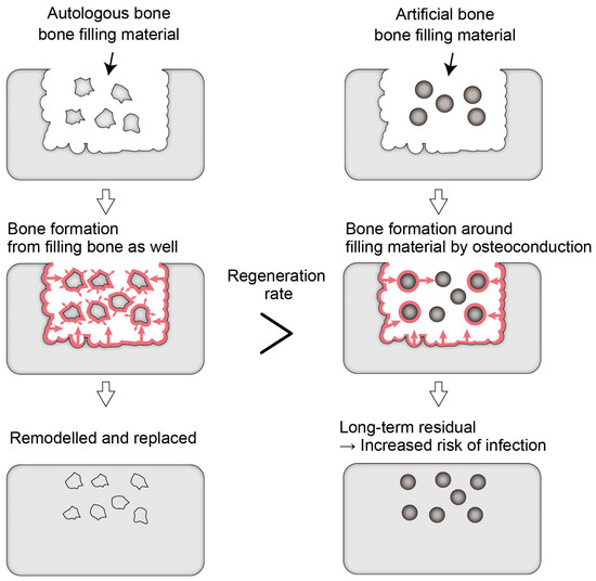 From Tooth Adhesion to Bioadhesion: Development of Bioabsorbable Putty ...