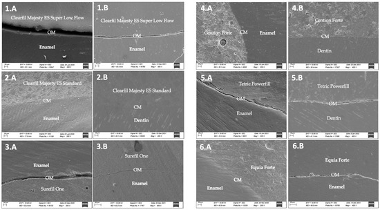 Comparison of Class II Bulk-Fill, Self-Adhesive Composites, Alkasite ...