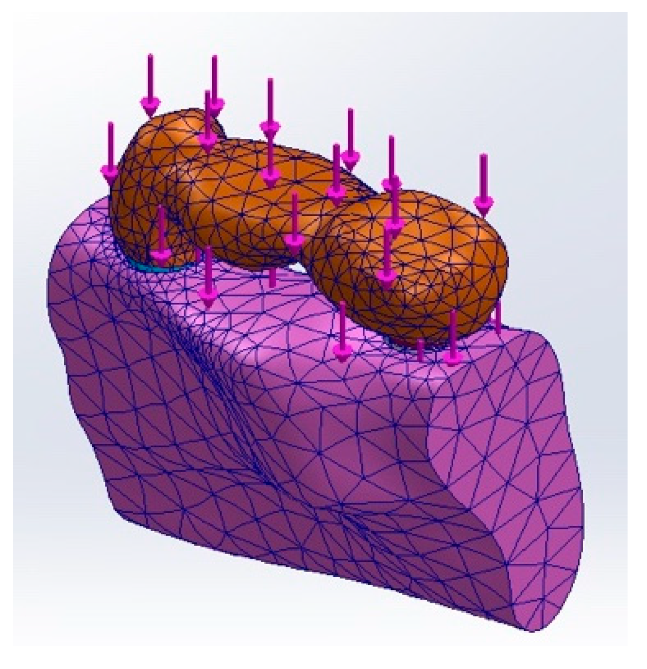Influence of Connector Design on Displacement and Micromotion in Tooth ...