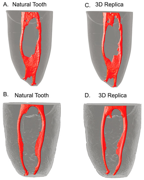 Comparative Micro-CT Analysis of Minimally Invasive Endodontic Systems ...