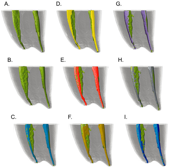 Comparative Micro-CT Analysis of Minimally Invasive Endodontic Systems ...