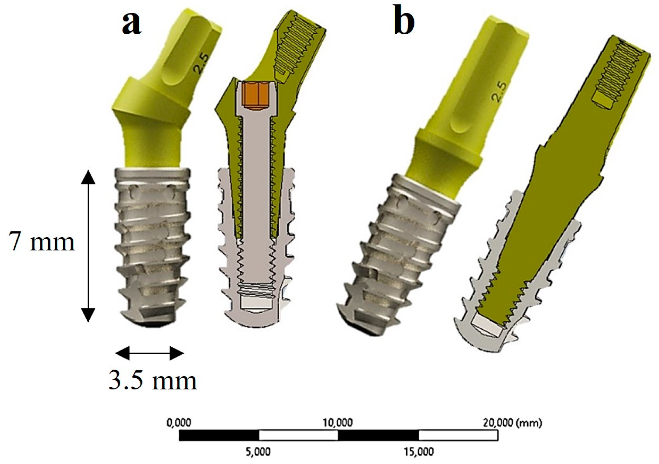 Biomechanical Finite Element Analysis of Two Types of Short-Angled ...