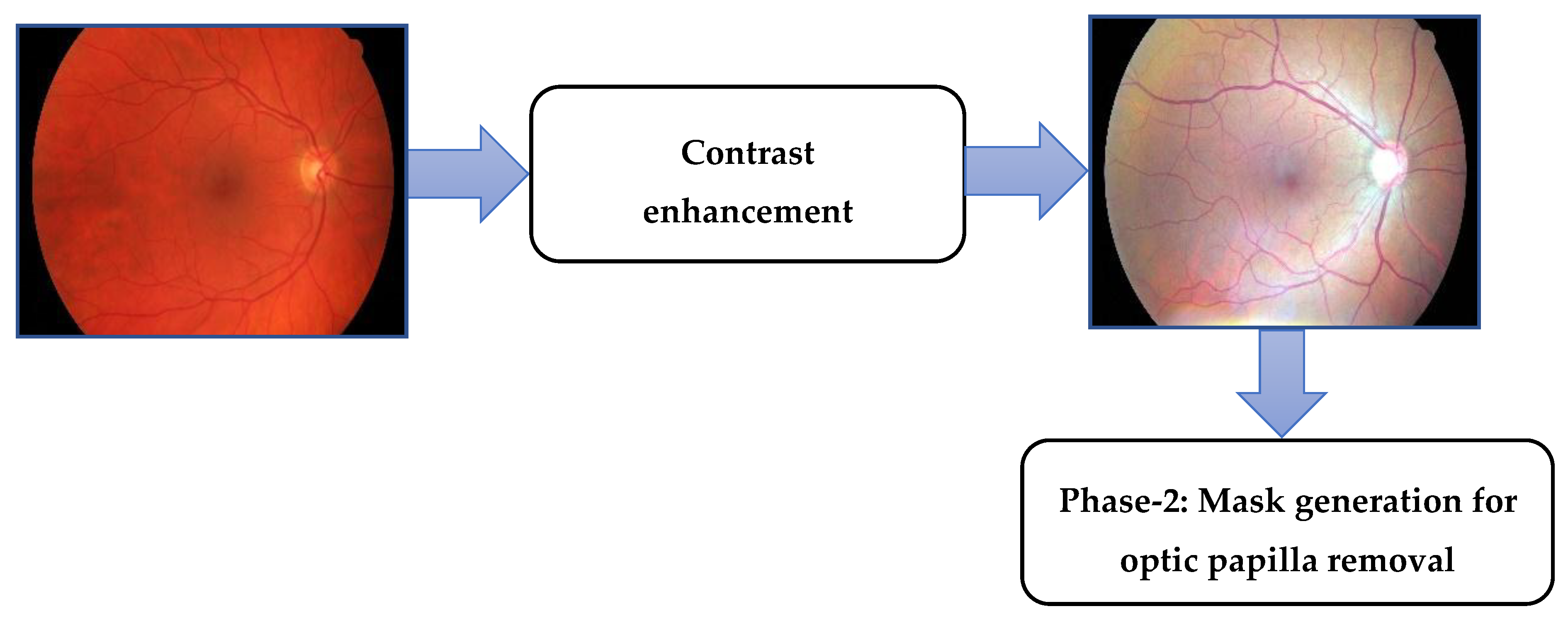 Process Of Retinal Vessel Segmentation Using Mlp Images Process Of Retinal Vessel Segmentation Using Mlp Images