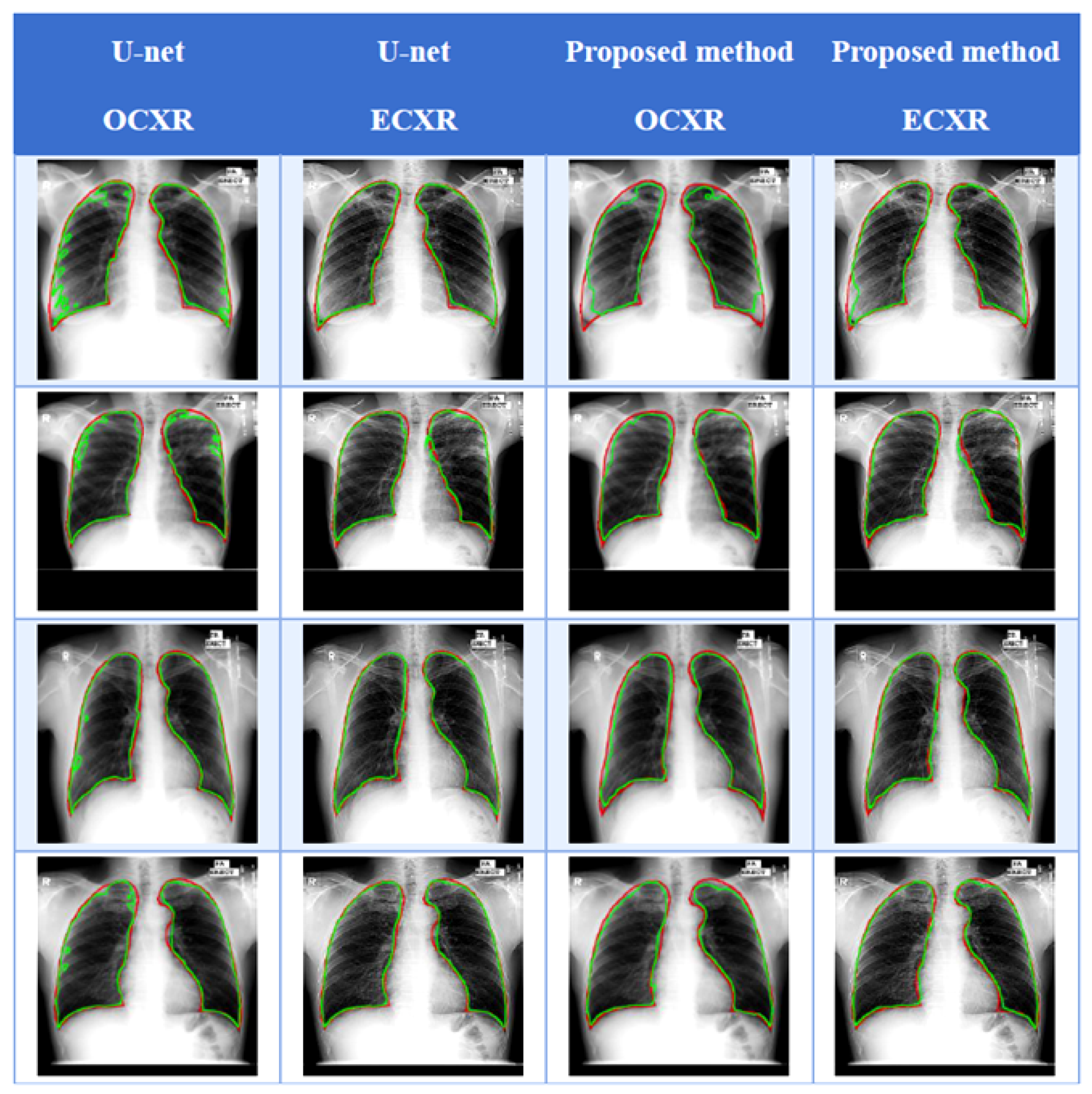 Mathematics | Free Full-Text | Lung X-ray Segmentation using Deep Convolutional Neural Networks ...