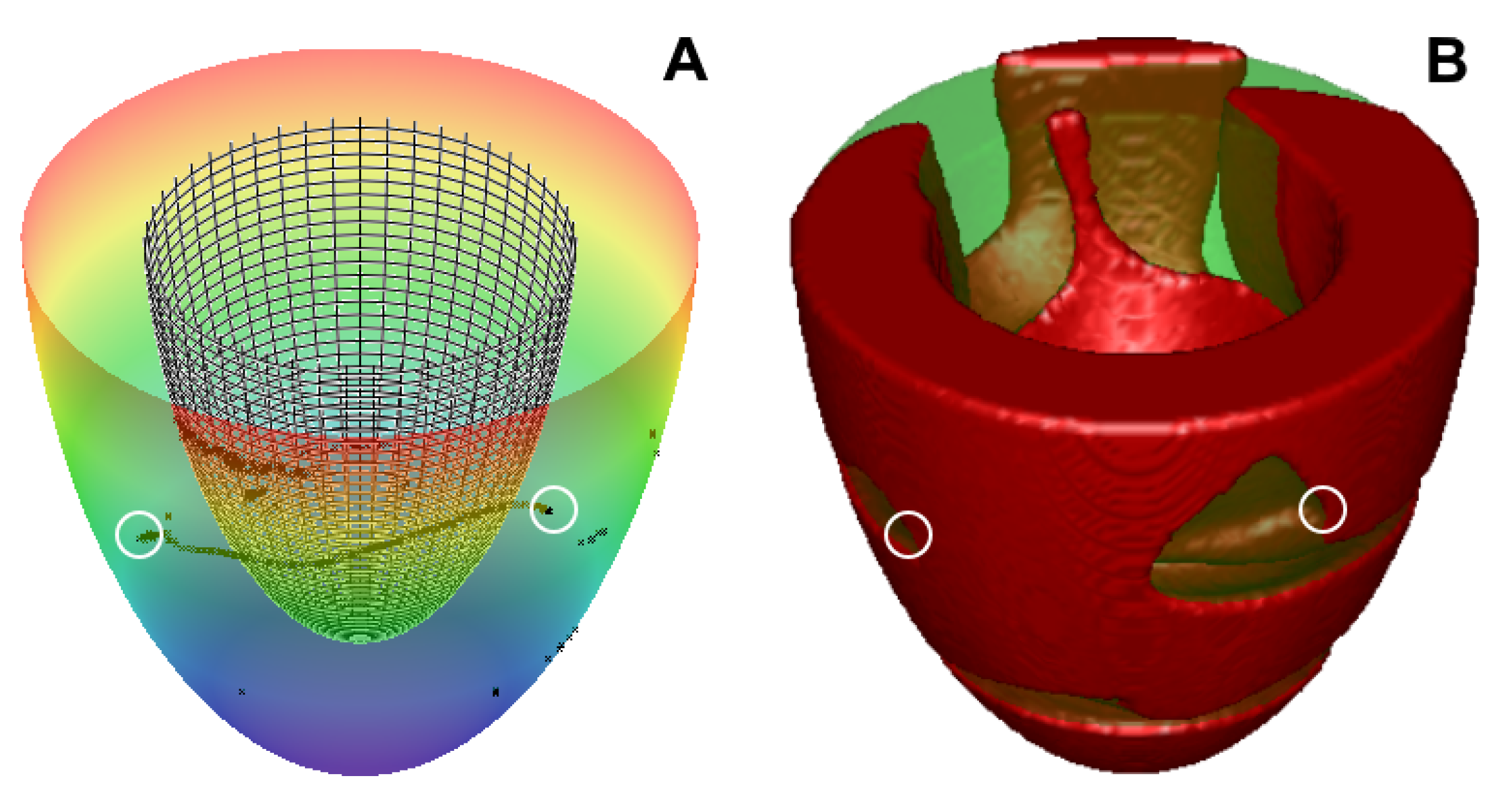Drift of Scroll Waves in a Mathematical Model of a Heterogeneous Human ...
