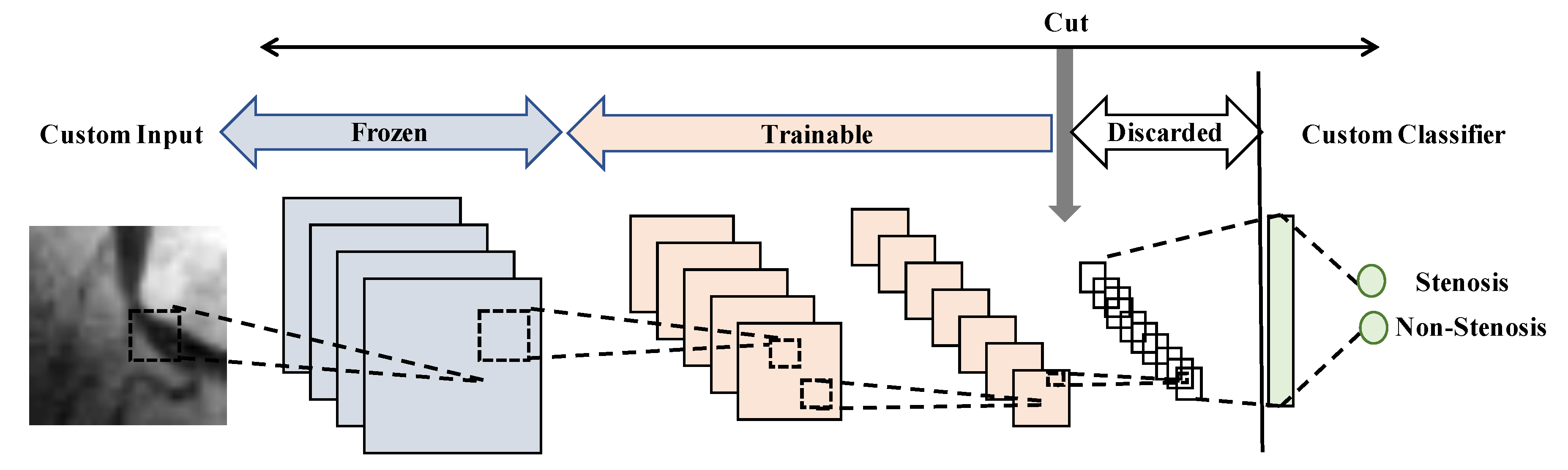 Mathematics | Free Full-Text | Transfer Learning for Stenosis Detection ...