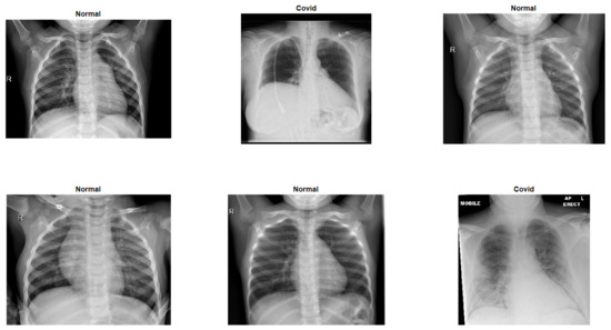 Evolving Deep Learning Convolutional Neural Networks for Early COVID-19 ...